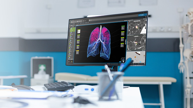 Corelinesoft More Notice