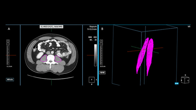 Corelinesoft More Notice
